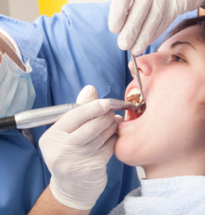 Teeth Polishing: Traditional vs. Prophy-Jet - Surf City Dentist